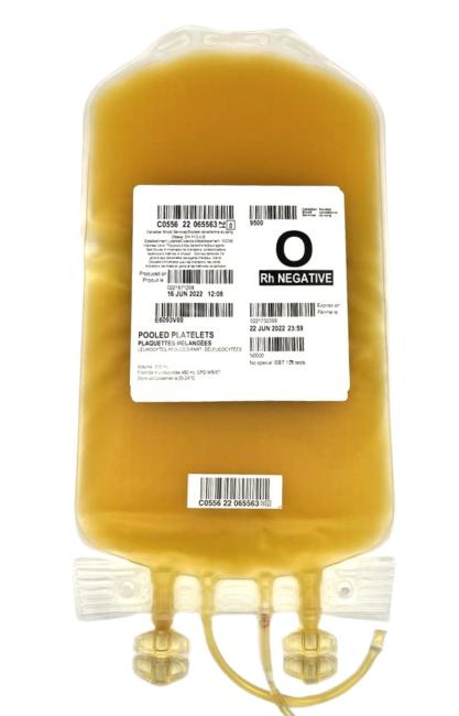 Platelets: Red blood cell contamination | Professional Education